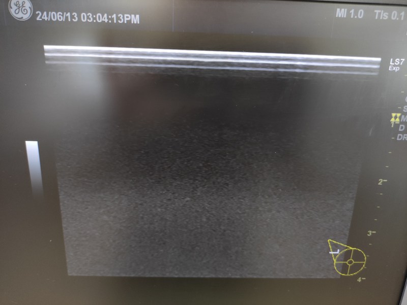 GE Healthcare｜Ultrasound system(Color)｜15134｜Quon Healthcare Inc.