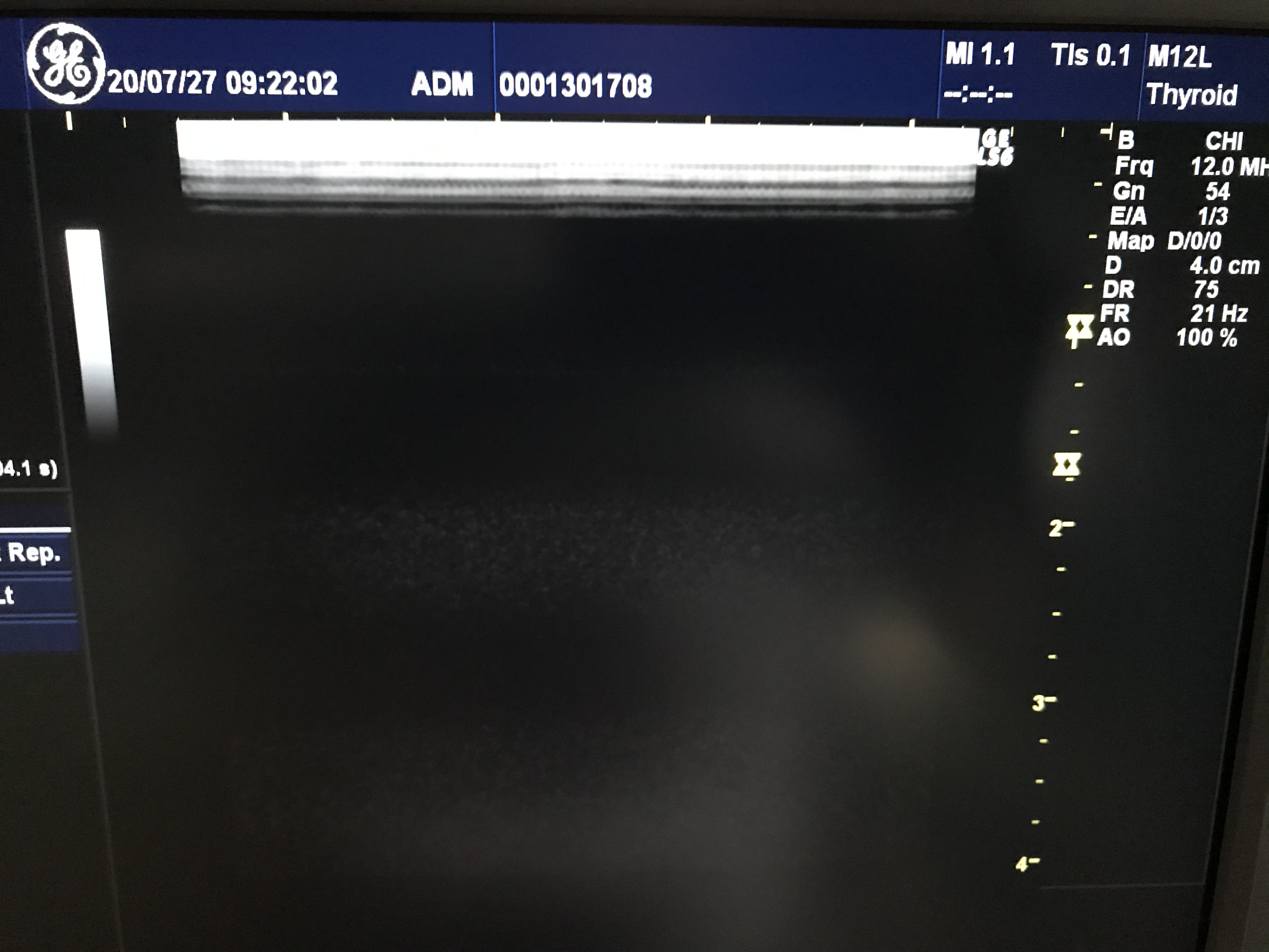 GE Healthcare｜Ultrasound system｜10759｜Quon Healthcare Inc.