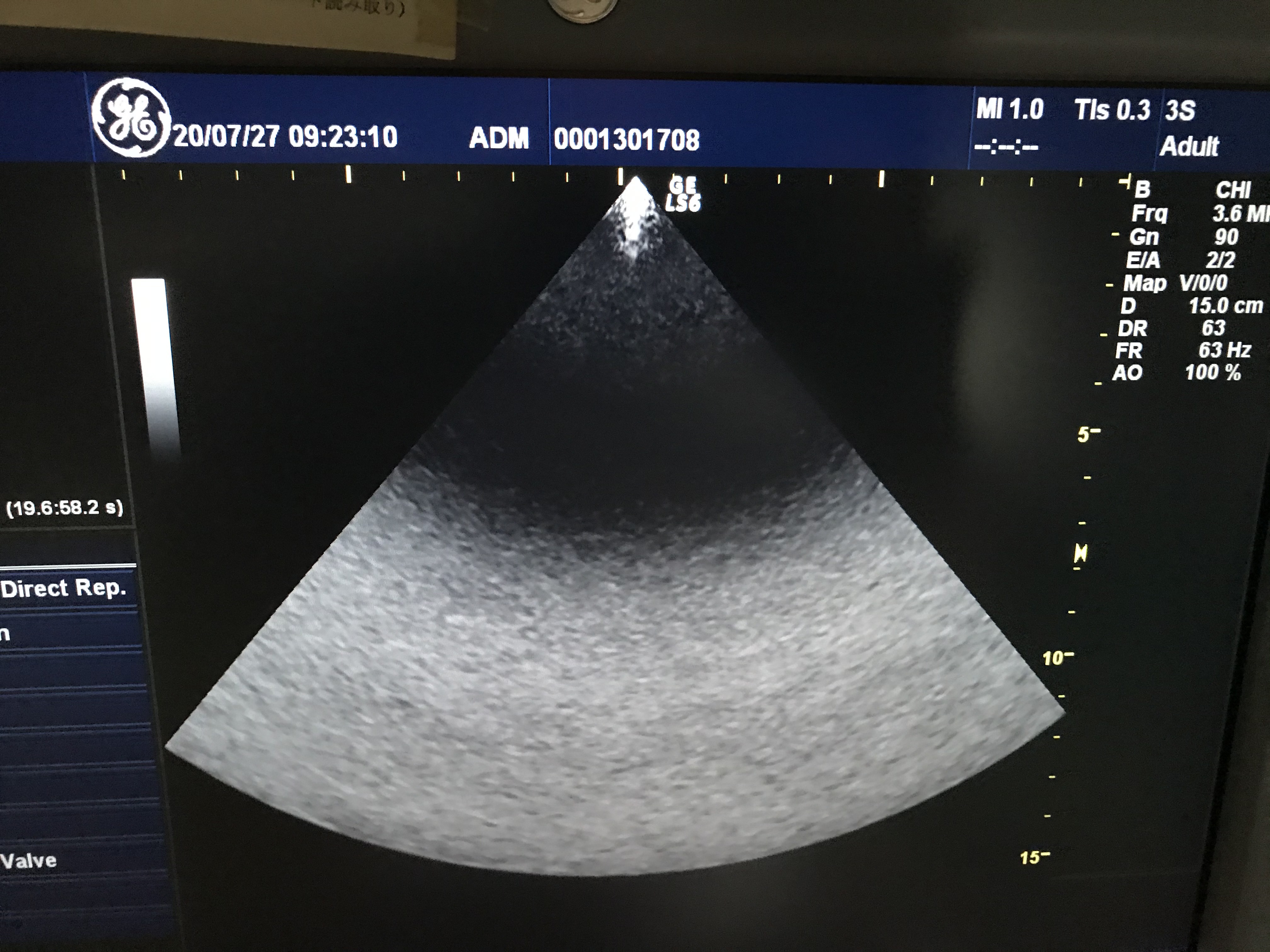 GE Healthcare｜Ultrasound system｜10759｜Quon Healthcare Inc.