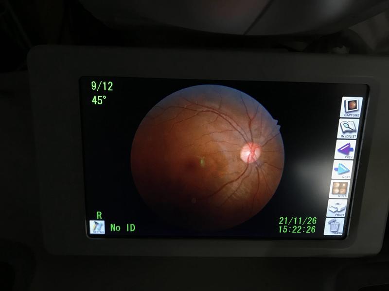 kowa｜Retinal Camera｜12162｜Quon Healthcare Inc.