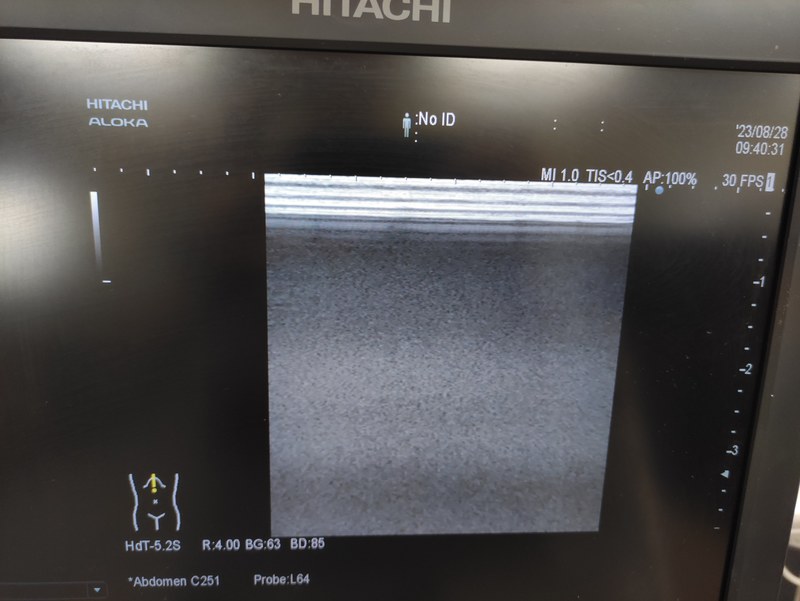 Hitachi｜Ultrasound system｜14212｜Quon Healthcare Inc.